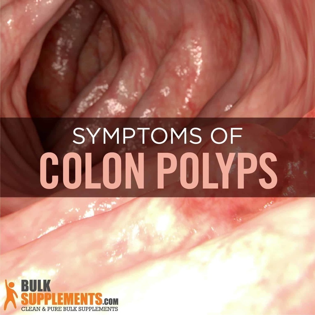 Tablo Read Colon Polyps Symptoms Causes Treatment By